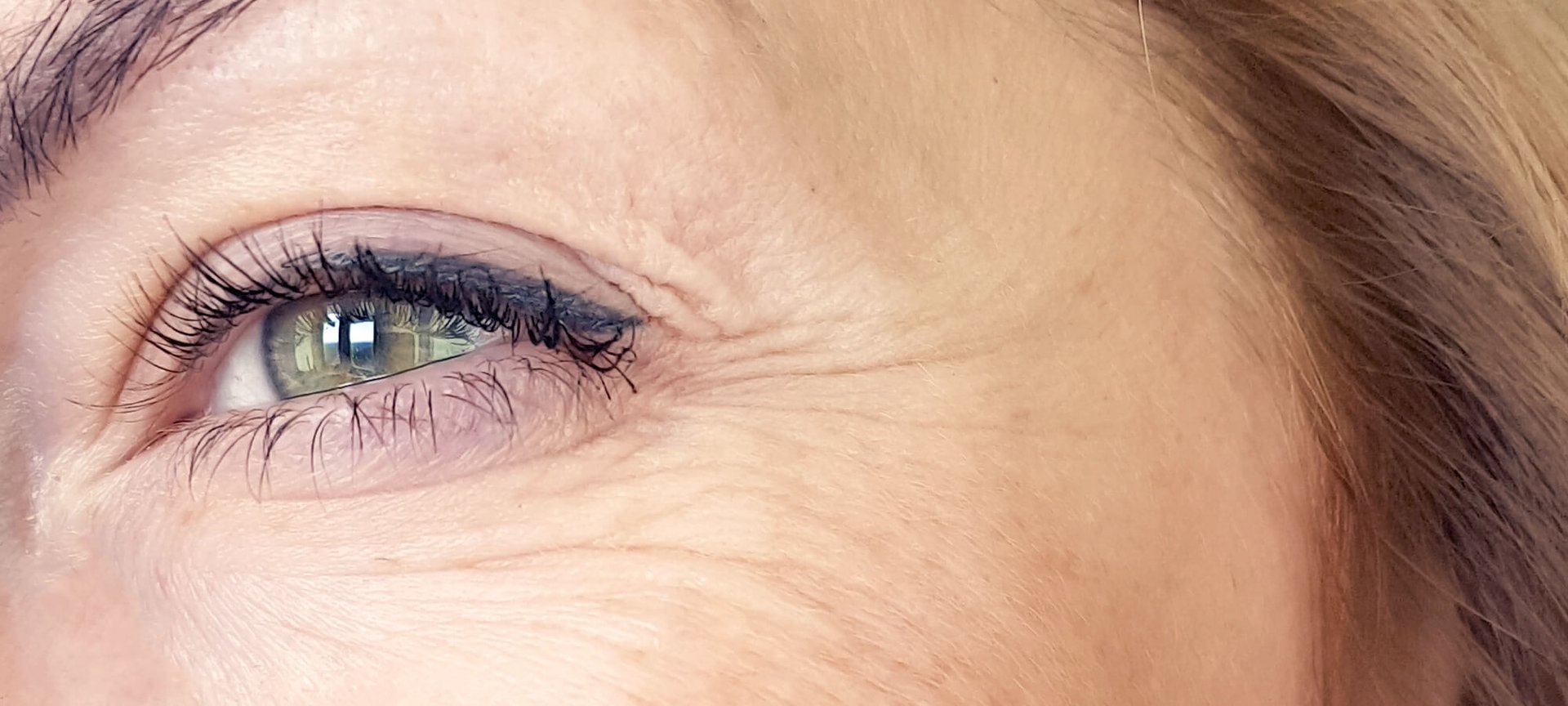 Help, I've got vertical lines cropping up under my eyes! - L'Oréal Paris